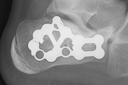 Management | The Bone School